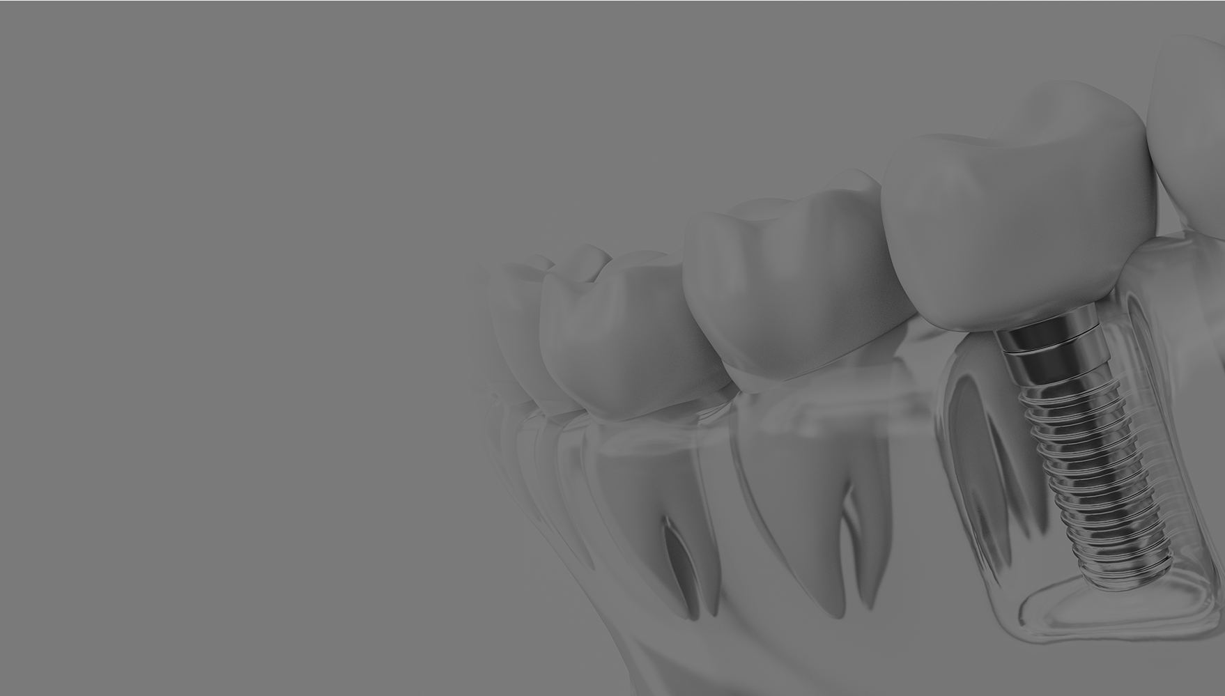 What to Expect – Lane Oral & Maxillofacial Surgery